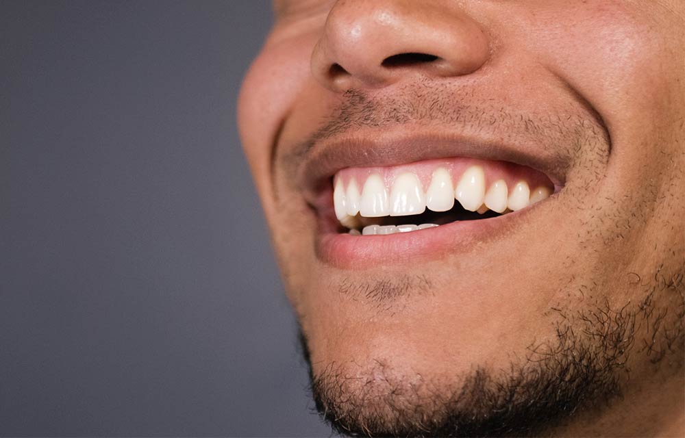 Color de mi encía = Salud de mi encía - Clínica dental MAIP en Zaragoza